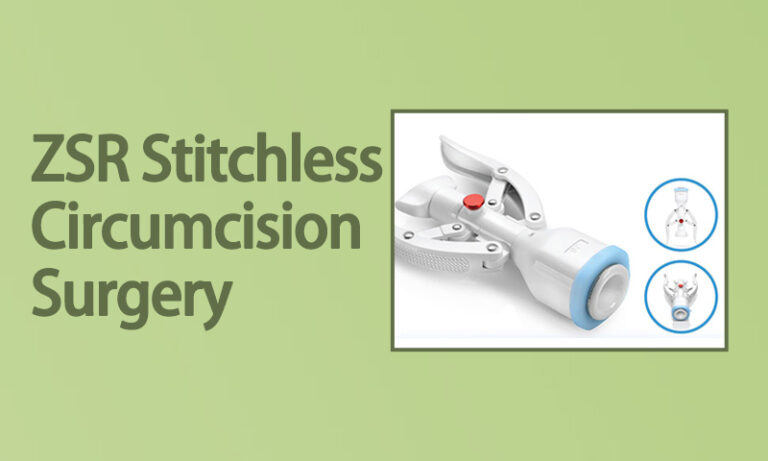 ZSR Circumcision Surgery in Jalandhar | Stapler circumcision for Tight ...