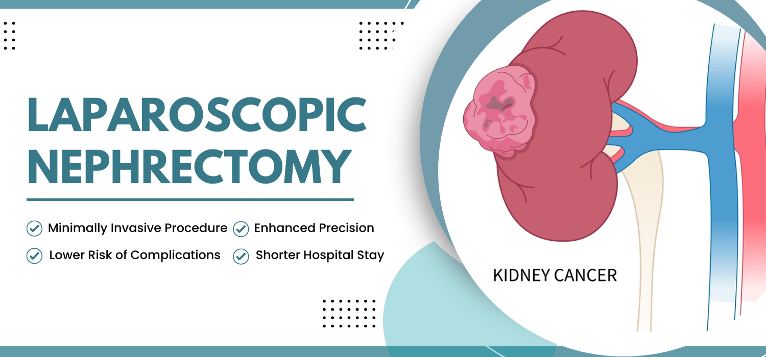 Laparoscopic Nephrectomy in India - Dr. Jasmeet Singh Ahluwalia